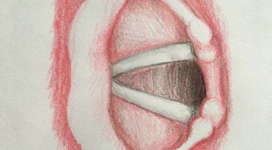 Vocal Cord Dysfunction | Trudy Lynch Speech Pathology